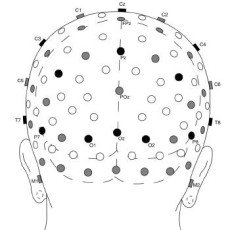 tDCS Electrode Placement Guide - Total tDCS